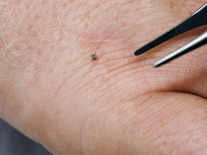 Ilmastonmuutos ennakoi tutkijan mukaan yhä tukalampia punkkivuosia ...