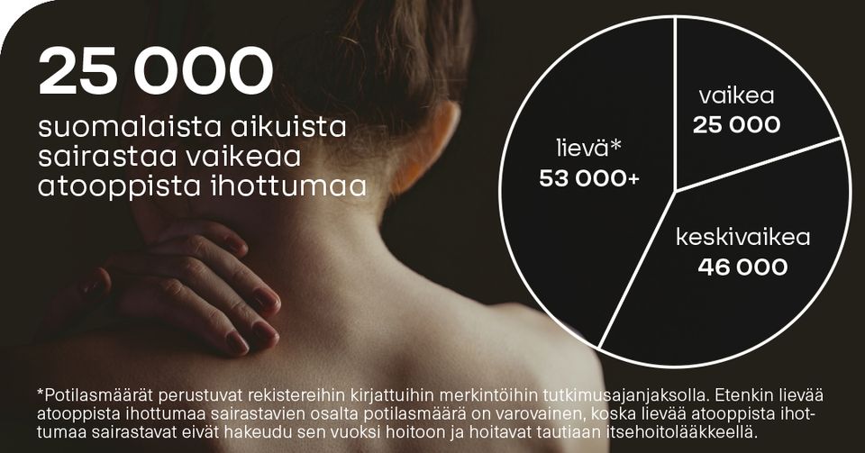 Atooppinen ihottuma enemmän kuin pinnallinen ihovaiva - Uutiset - Aamuset