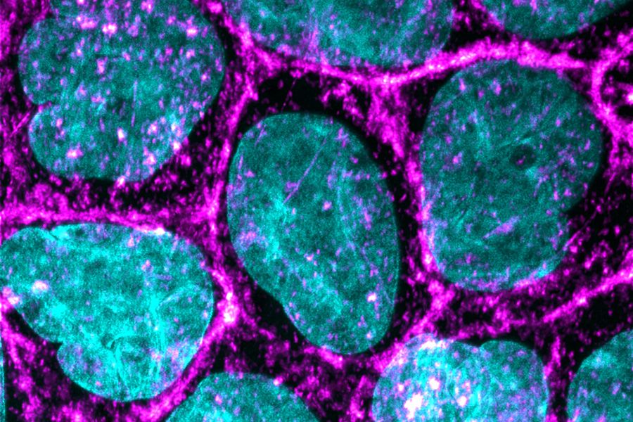 Solut reagoivat nopeasti pieniin valolla aikaansaatuihin ...
